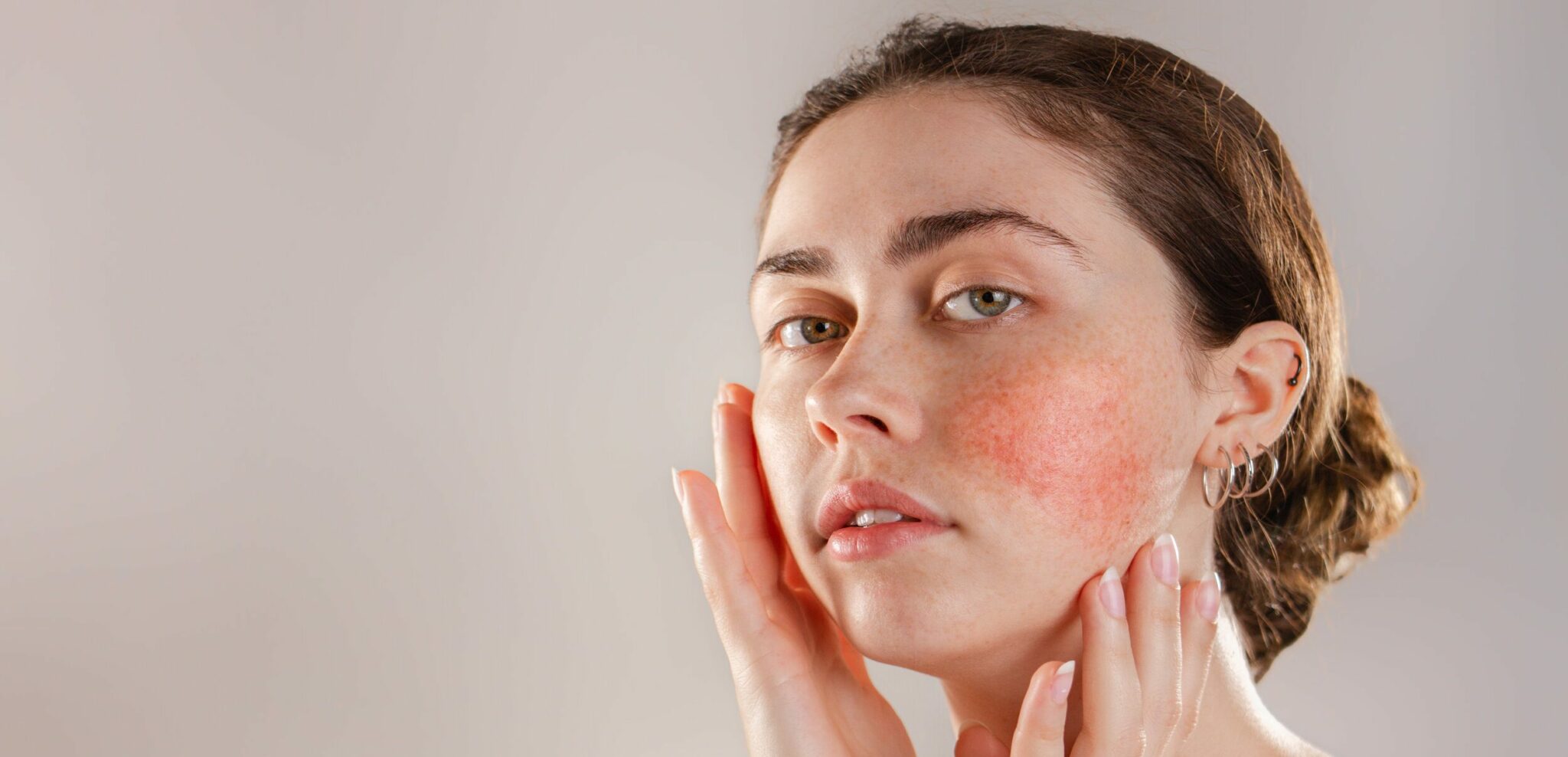 Erysipel Behandlung | Symptome & Vorbeugung